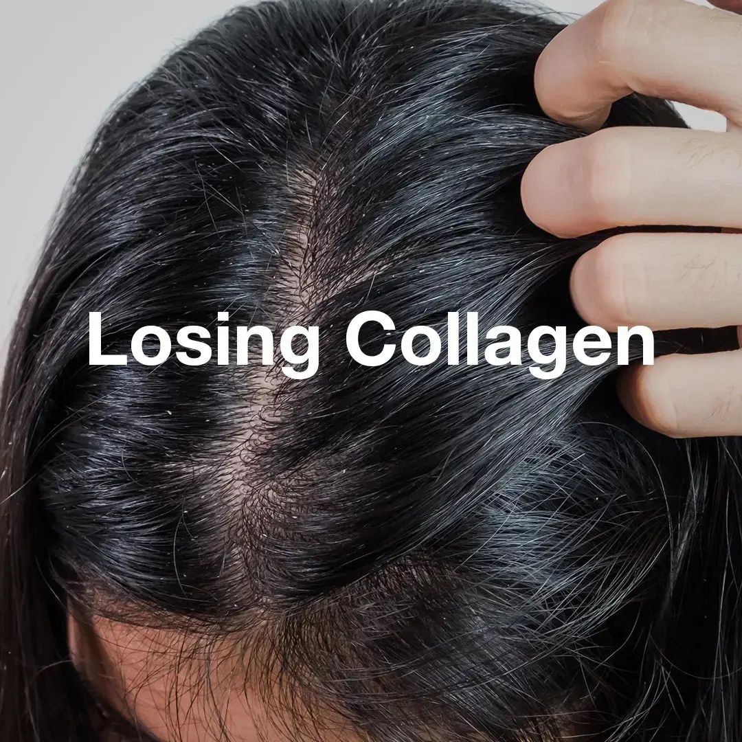 Losing Collagen + How To Support It! – Soulflower.in