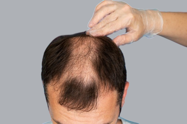 10 Simple Ways to Control Hair Fall Due to Environmental Damage ...